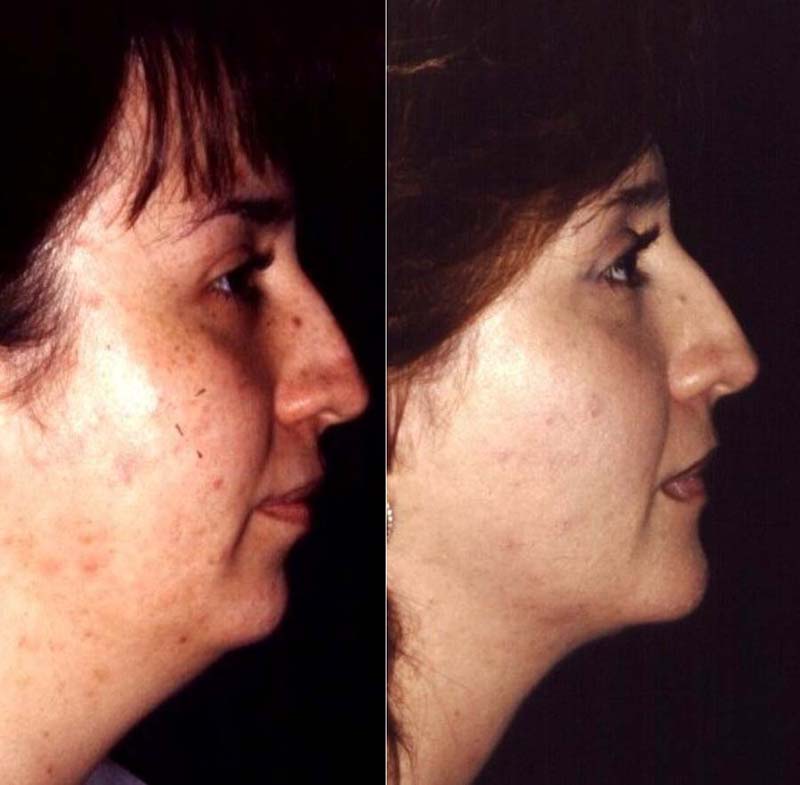 CIRUGÍA ESTÉTICA PARA JÓVENES - DR. SANTIAGO UMAÑA